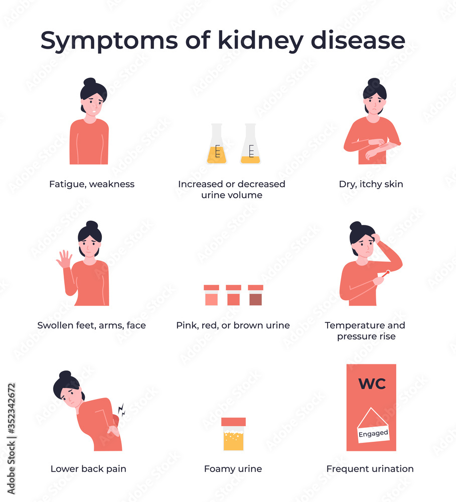 Set symptoms of kidney disease. Flat vector cartoon modern illustration ...
