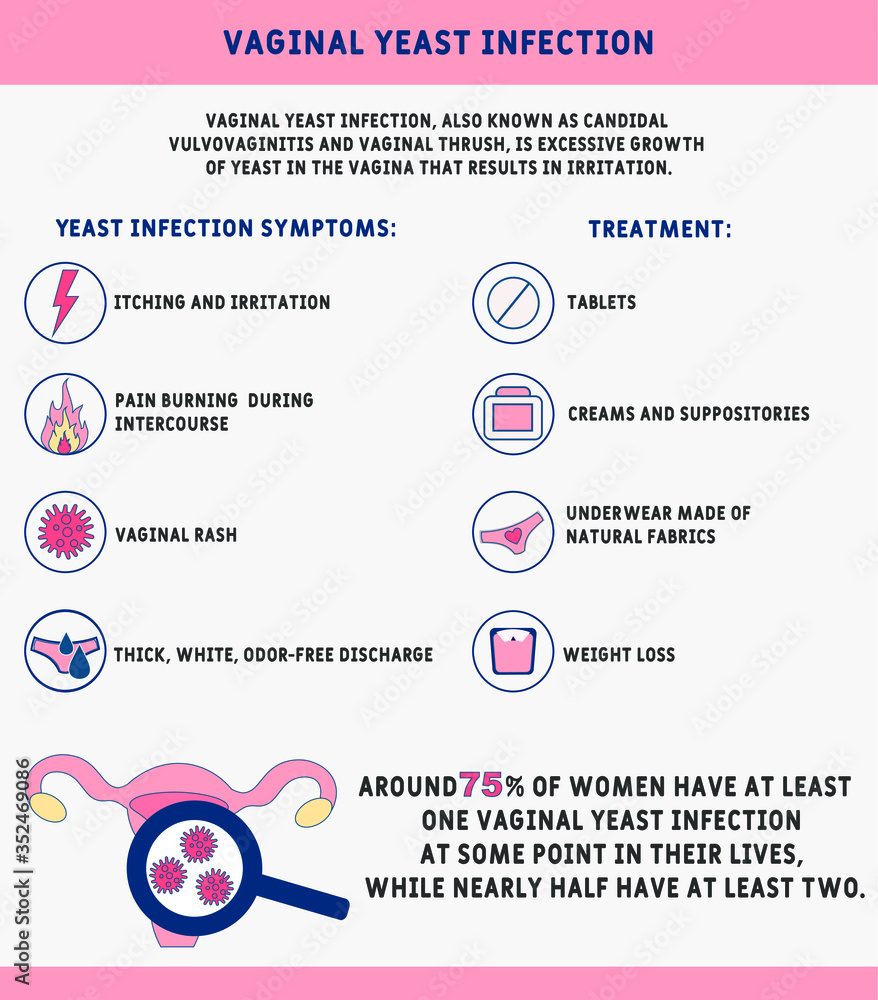 Vaginal yeast infection. Candidiasis. Ginecological medical desease ...