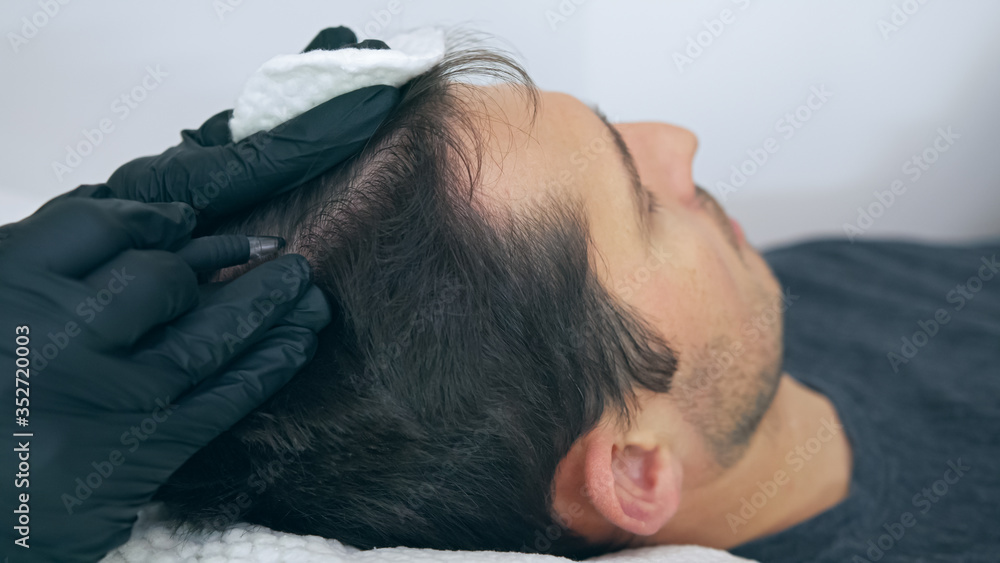 High quality close-up of a man laying on a couch during the esthetician ...