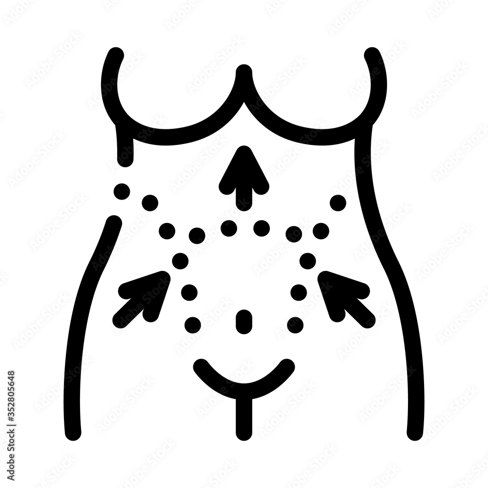 tummy tuck icon vector. tummy tuck sign. isolated contour symbol ...