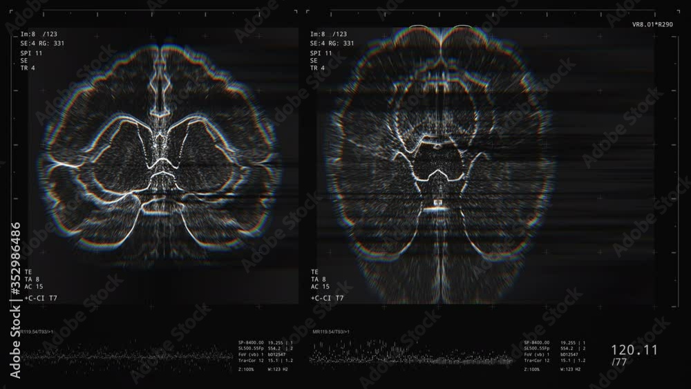 Vídeo do Stock: Brain scan visualization footage. The device scans and ...