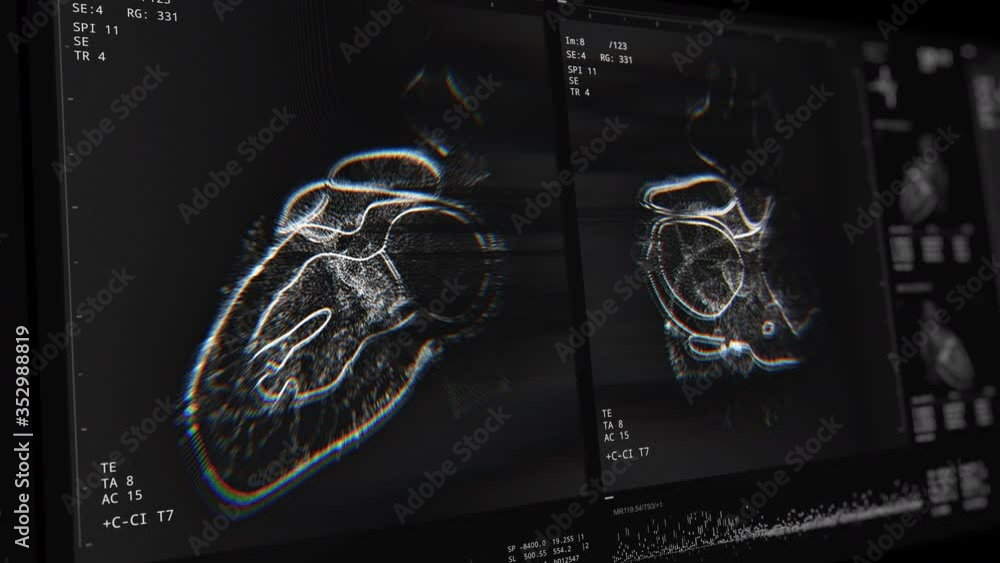 Heart scan screen animation. The device scans and displays vital signs ...