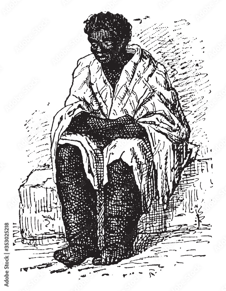 Elephantiasis, vintage illustration. Stock Vector | Adobe Stock