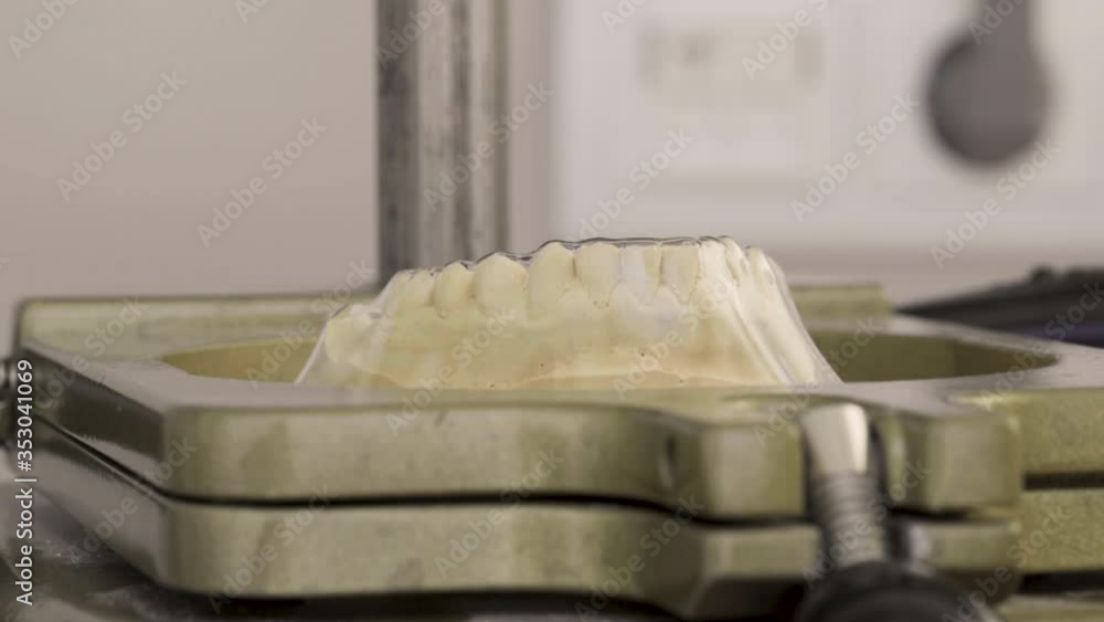 Making A Invisalign Retainer By Moulding Thermoplastic Material On A ...