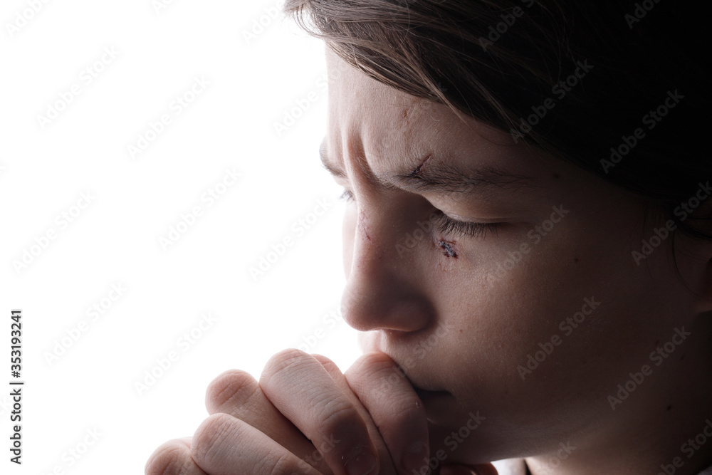 Portrait of young boy crying with sad eyes with wound on his face ...
