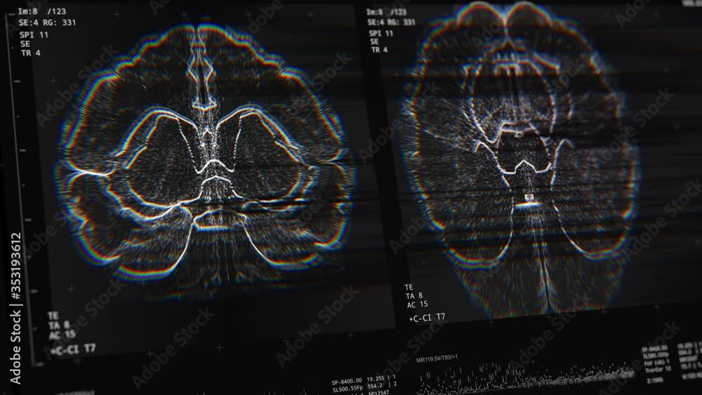 Brain scan screen animation. The device scans and displays vital signs. Neurology data ...