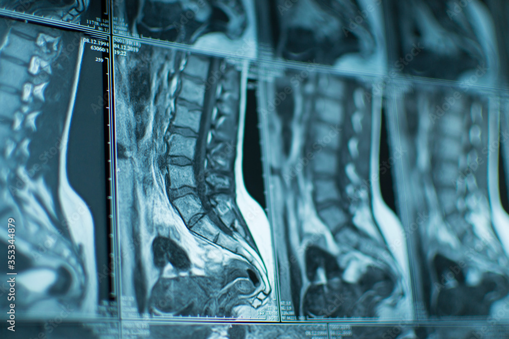 MRI of the spine. X-ray of the back to the lumen. Medical business ...