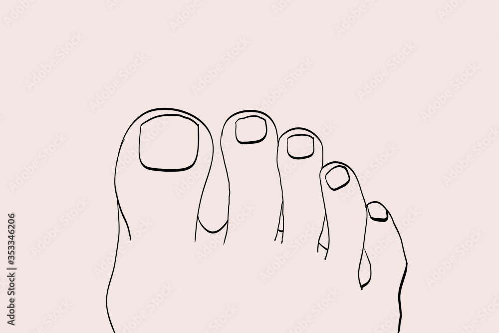foot drawn with podiatry problems. Fingers and nails to be restored for ...