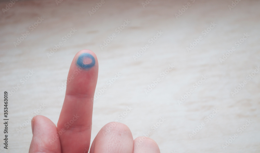 Blue circle on the finger. Symbol of diabetes. World Diabetes Day ...
