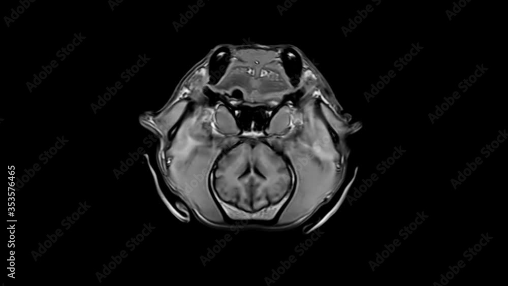 Magnetic resonance Imaging of the Dog's Head - MRI vídeo de Stock ...