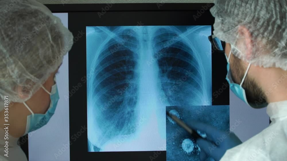 Team of scientists at computer monitor in laboratory analyzes lung x ...