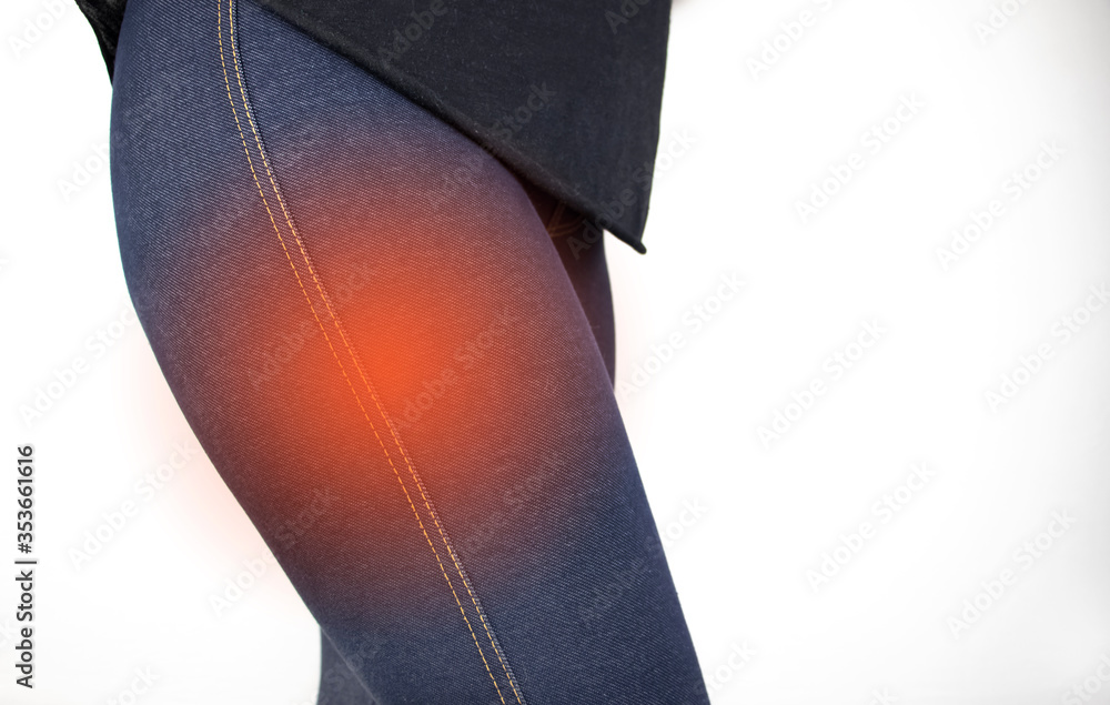 A woman suffers from pain in the outer thigh. The concept of treating a ...