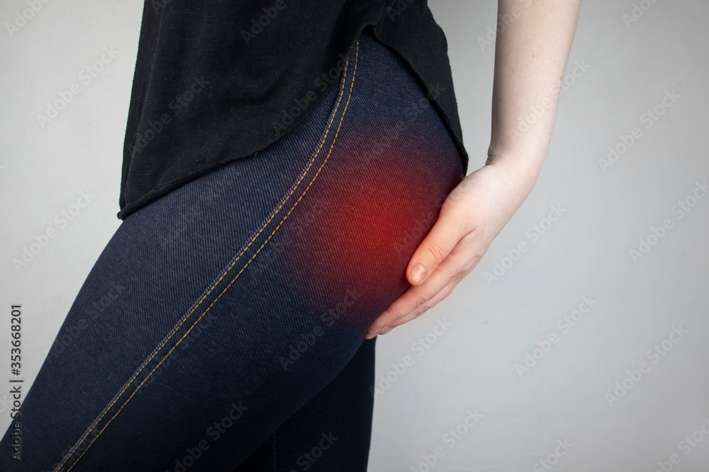 A woman suffers from pain in the buttock. The doctor diagnoses the ...