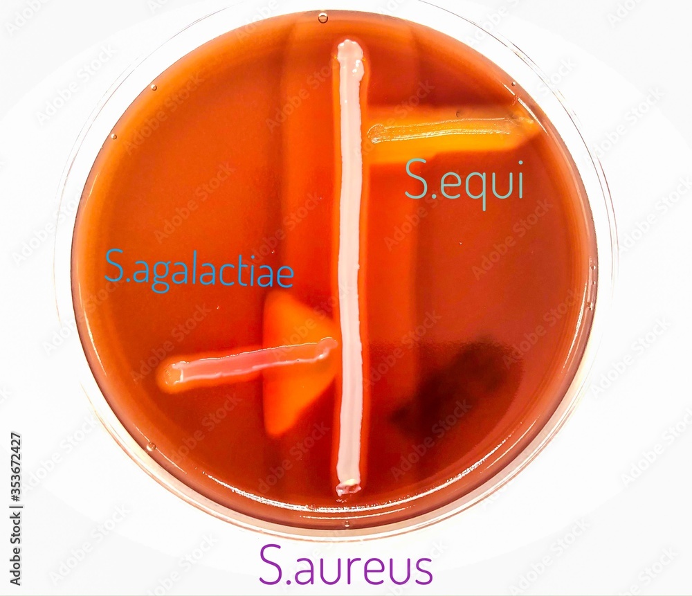 CAMP TEST for identify Streptococcus agalactiae foto de Stock | Adobe Stock