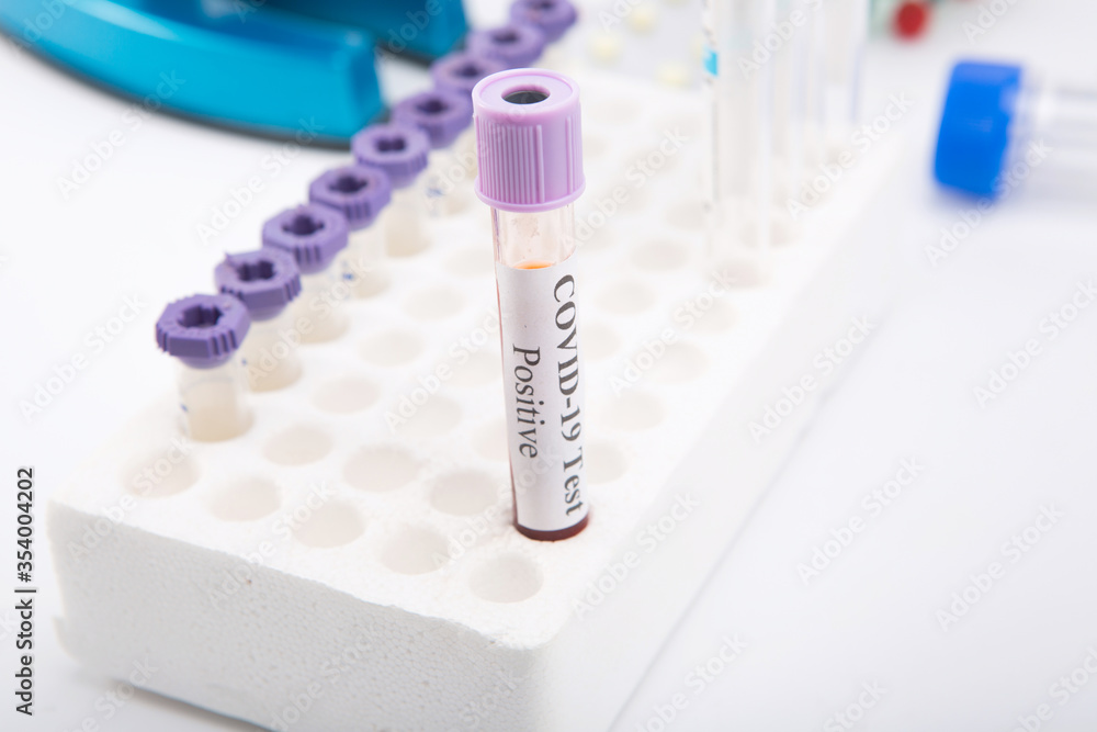 Test tube with a positive COVID-19 test on a white background Stock ...