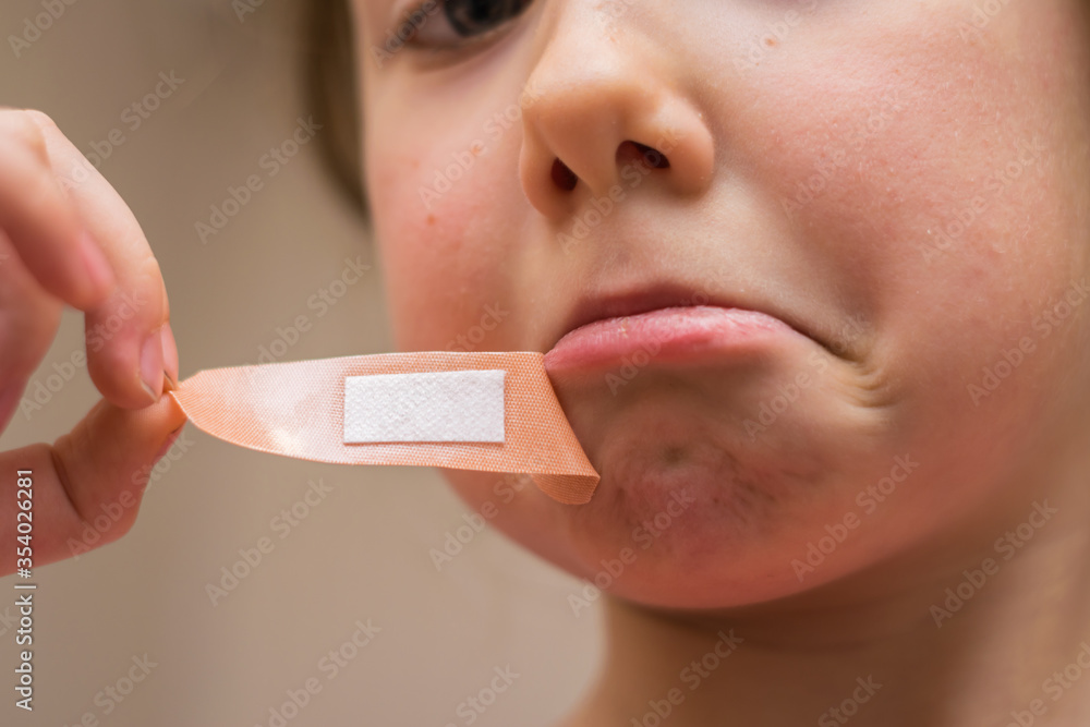 Child pulling the plaster off his face. A sad little girl removes a ...