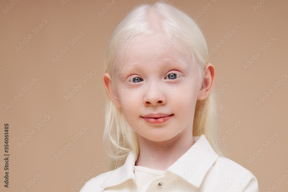 close-up portrait of little caucasian girl with albinism syndrome ...