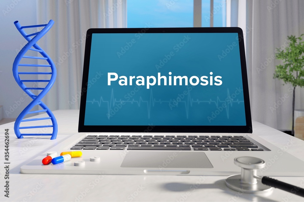 Paraphimosis. Medicine/healthcare. Computer in the office of a surgery ...