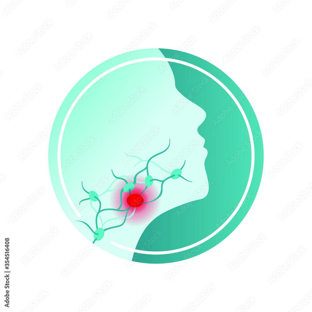 Lymphonodus inflammation - lymph nodes (gland) organs of lymphatic ...