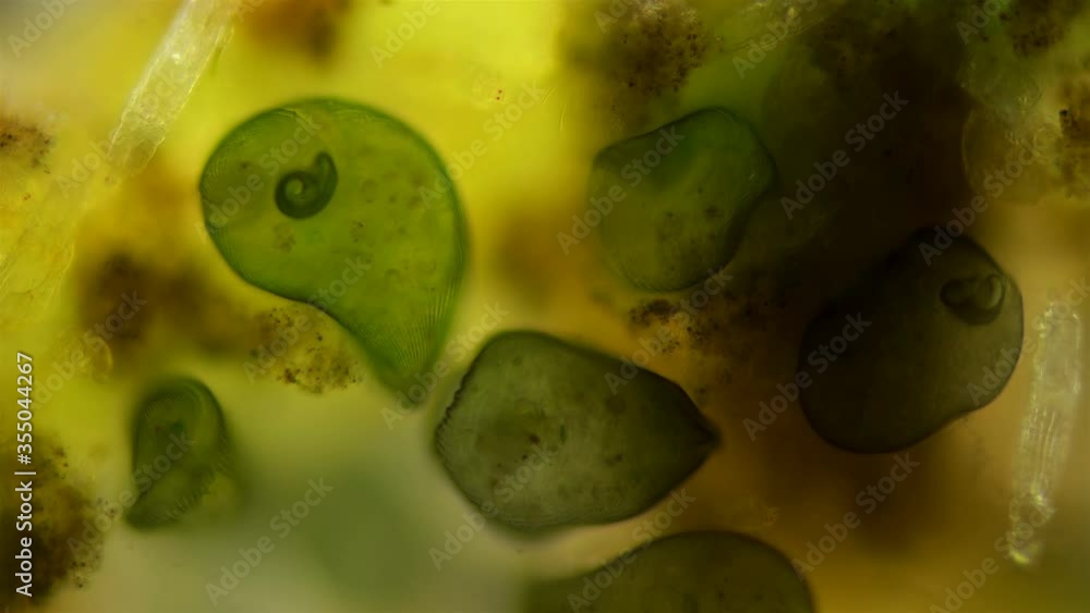 colony Infusoria Stentor under the microscope, the family Stentoridae ...
