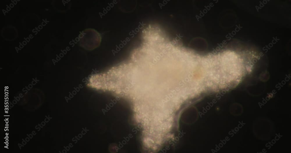 Amoebae move and feed by using pseudopods, which are bulges of ...