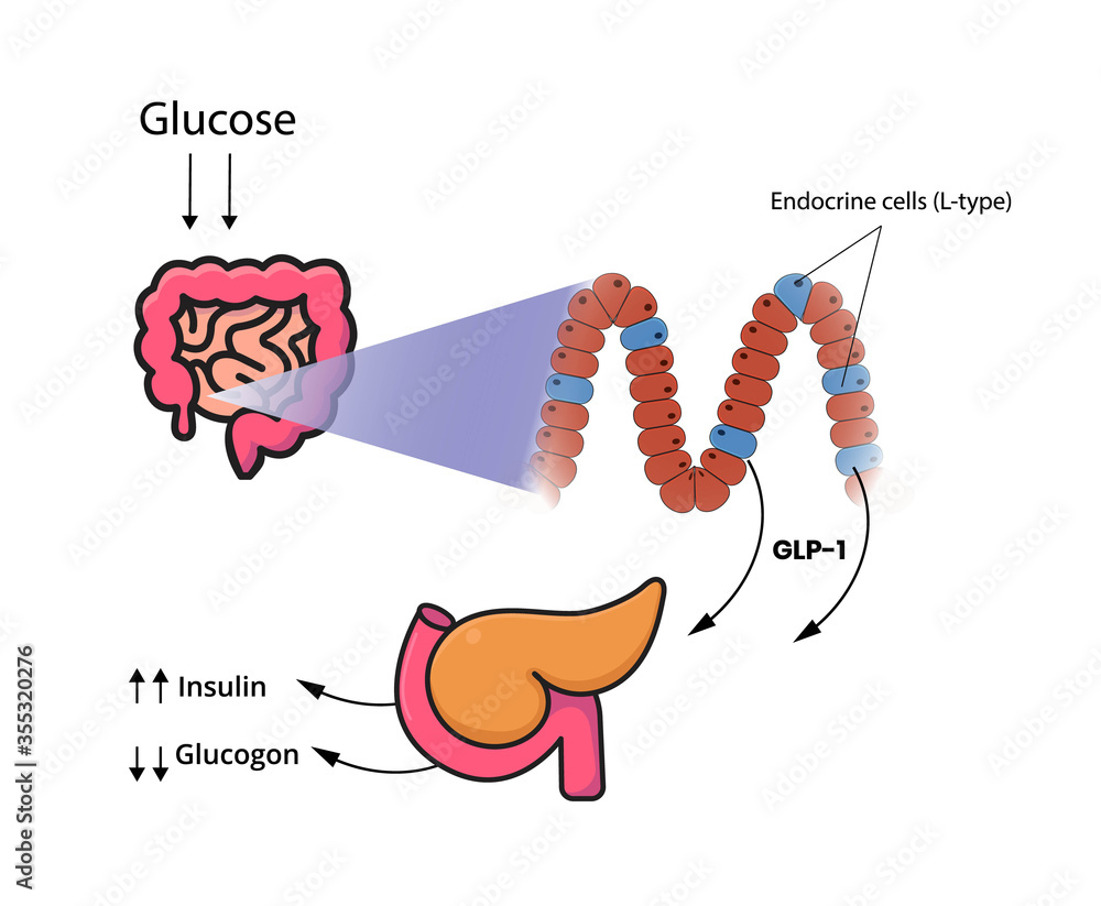 GLP-1 release by the cells of the small intestine and colon. L-cells ...