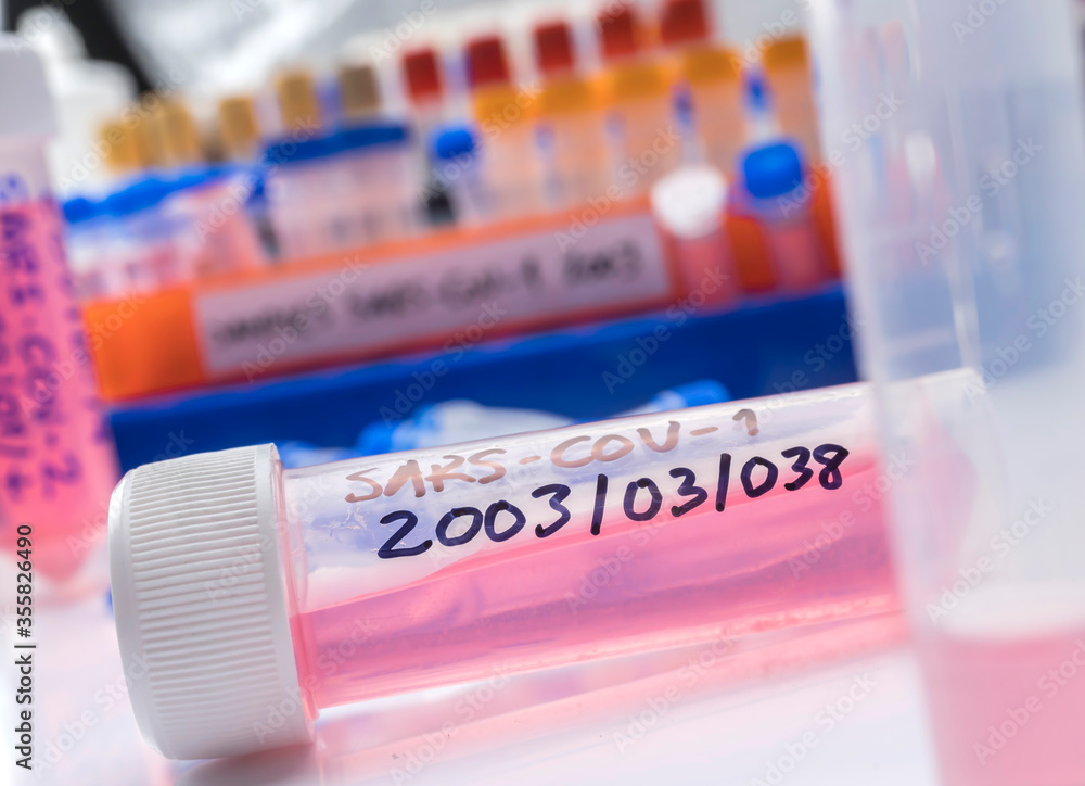 Vials with samples of SARS-COV-1 prepared cold in a laboratory ...
