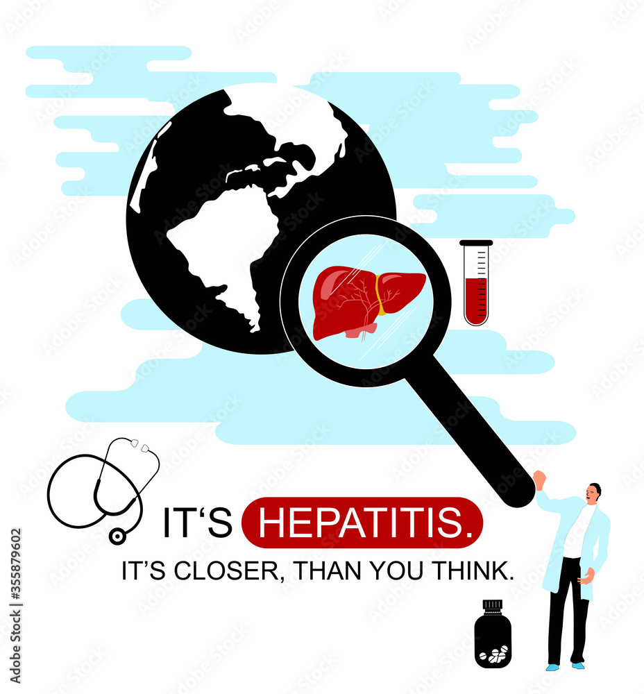 World hepatitis day 28th July cartoon flat vector illustration.Concept ...