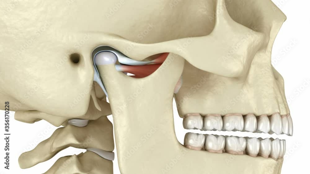 Temporomandibular joints and dislocated articular disc. Medically ...