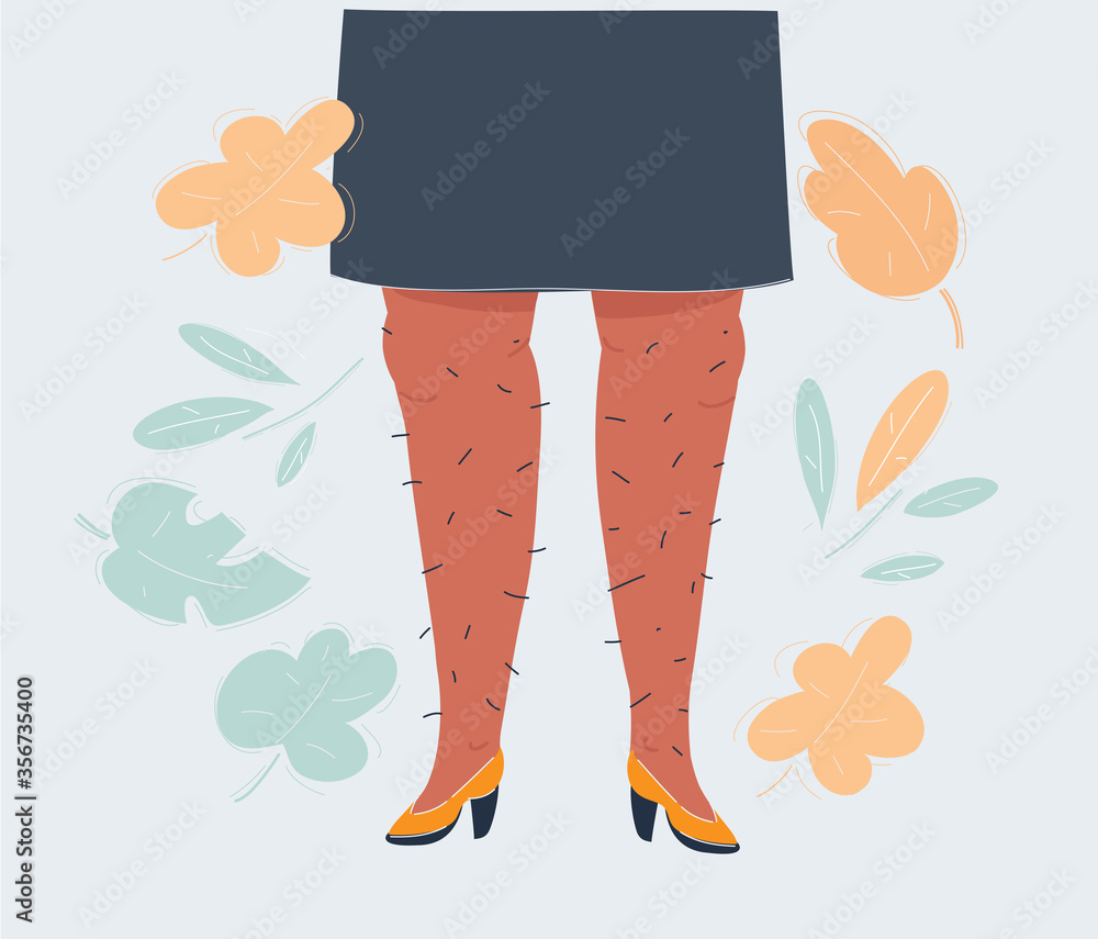 Vector illustration of Hairy legs on white background Stock Vector ...