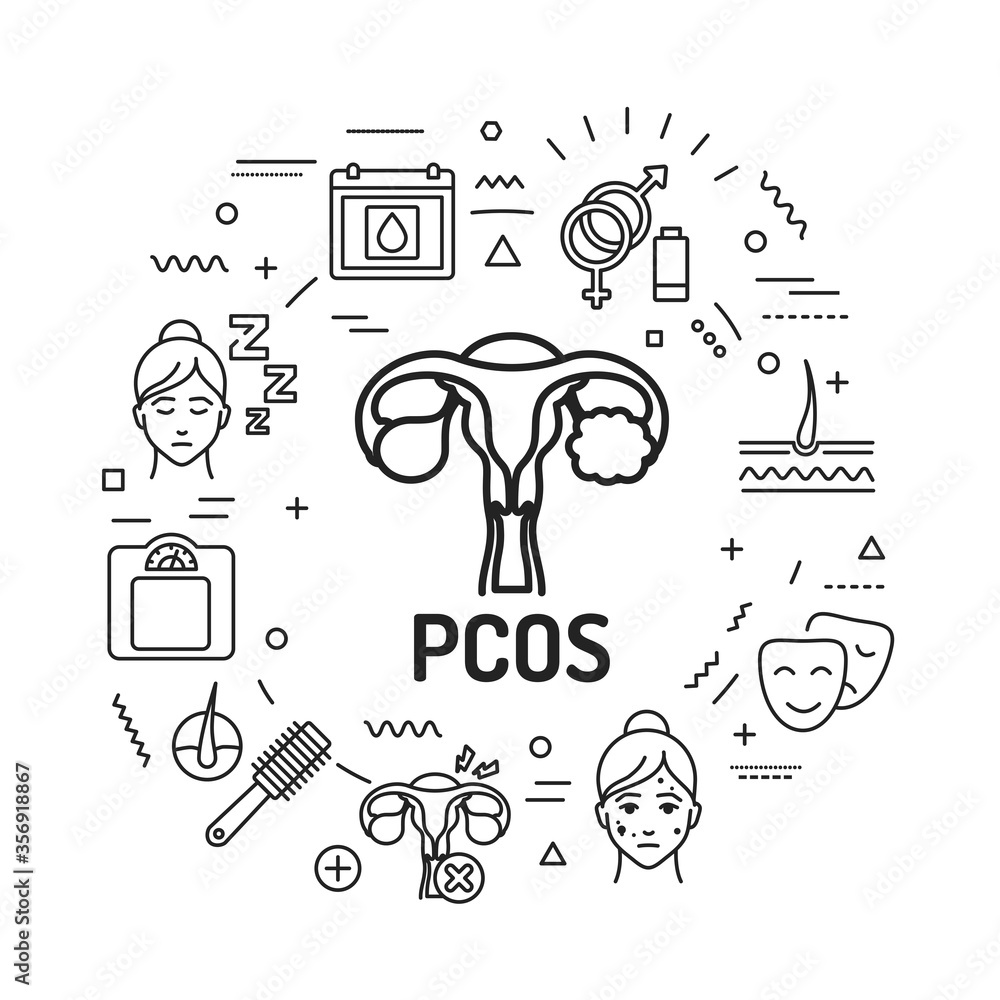 PCOS symptoms web banner. Female reproductive system disease ...