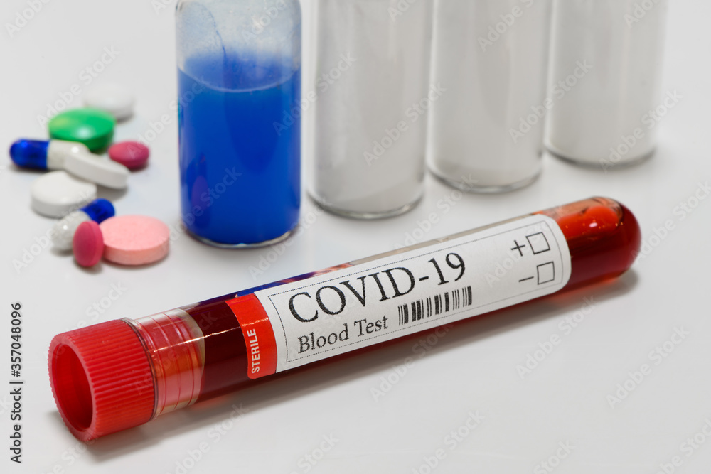 COVID-19 laboratory test tube and laboratory sample of blood testing ...