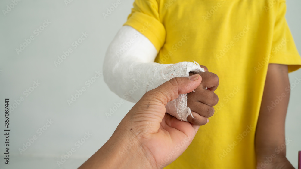 Cute boy hand bone broken from accident with arm splint Stock Photo ...
