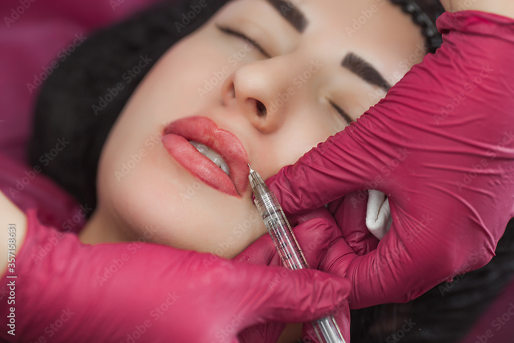 Procedure of lip augmentation in the beauty salon. Cosmetologist making ...