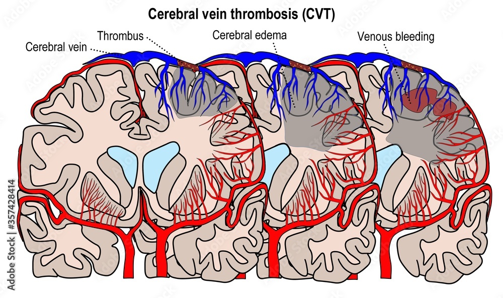 Arterial and venous circulation of human's brain and the cerebral vien ...