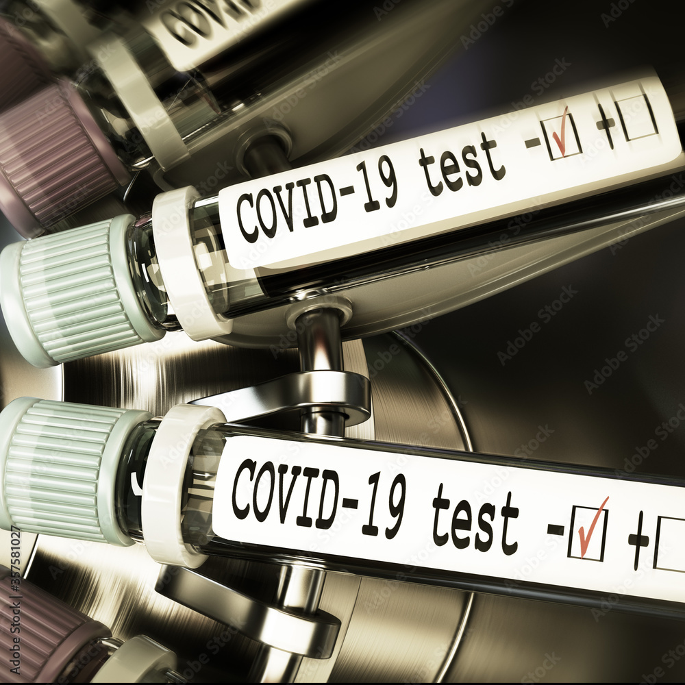Vials of blood in a centrifuge. Negative COVID-19 test and laboratory ...