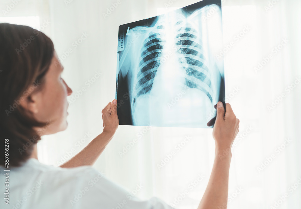 Female doctor checking patient's chest x-ray film lungs scans at ...