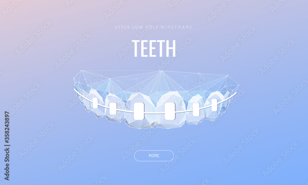 Teeth with braces low poly banner template. Orthodontic treatment ...