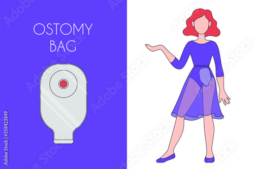 cartoon vector illustration of a ostomy bag. A patient with a colostomy ...