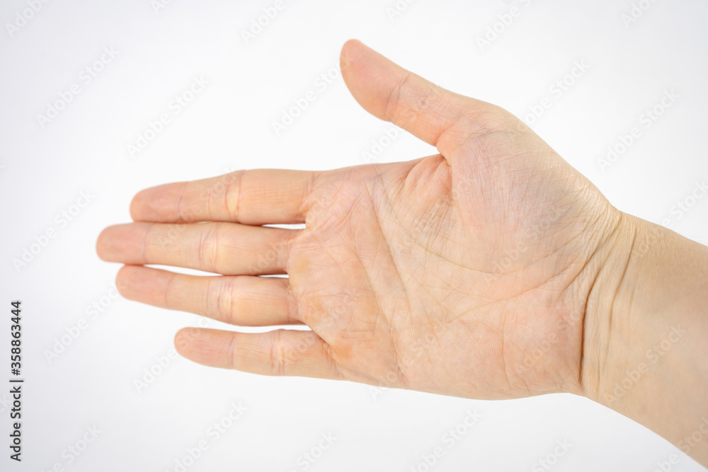 female hand with calluses on a white background, woman's hand isolated ...