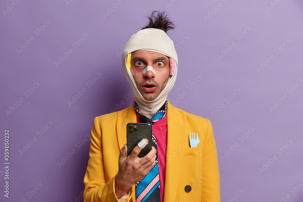Embarrassed shocked man has bruises and swollen face caused by physical ...