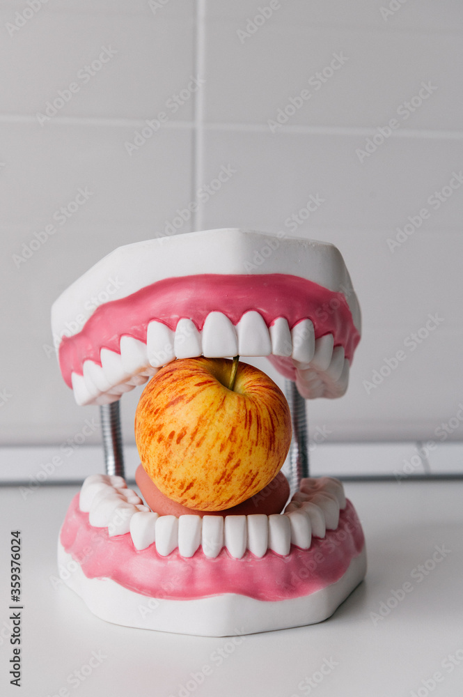 Dental layout of the jaw. Sound teethDental model of the jaw with apple ...