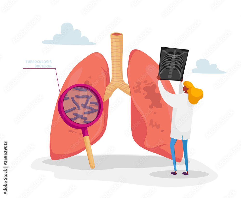 Pulmonology Specialist, Professional Doctor Character Holding X-ray ...