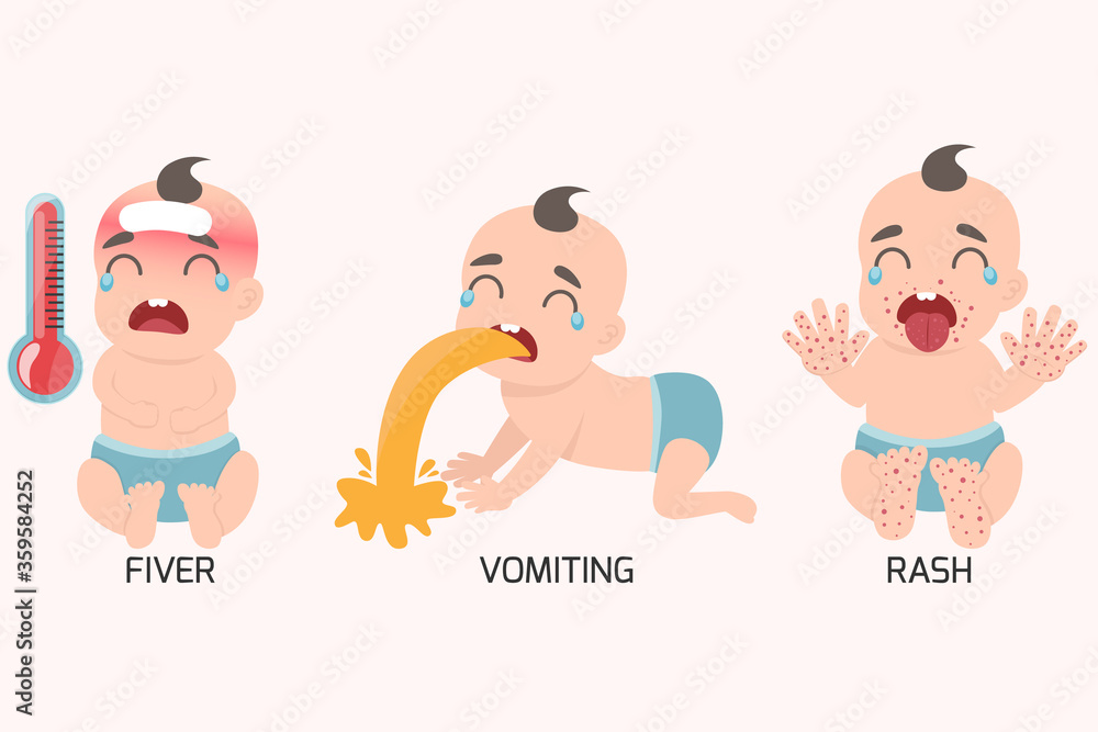 HFMD children infected. Hand-foot-mouth disease Infographics with ...