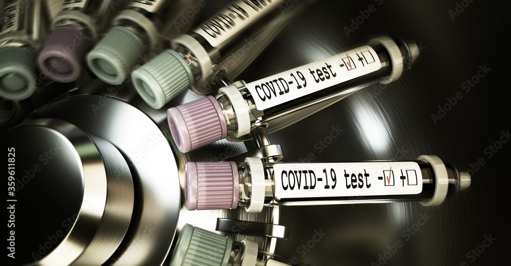 Vials of blood in a centrifuge. Negative COVID-19 test and laboratory ...