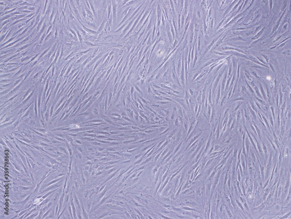 Fibroblasts ,the most common cells of connective tissue in animals ...
