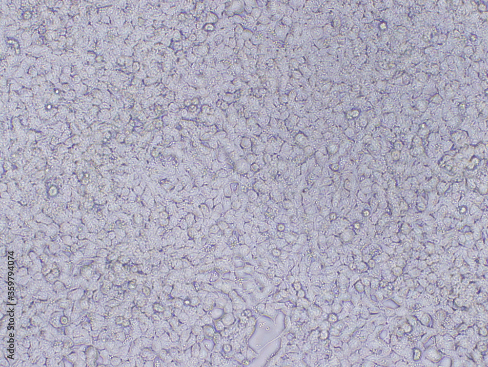 Human Embryonic Kidney Cells 293 (HEK-293 Cells) were captured by Light Microscope (100x) Stock ...