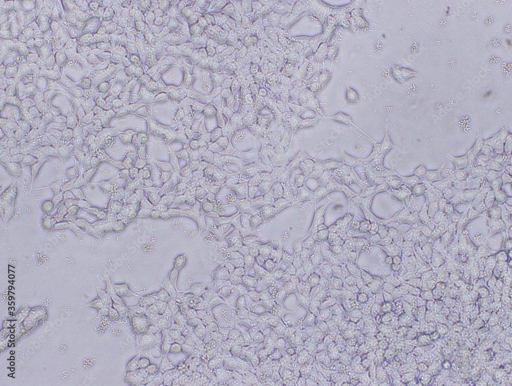 Human Embryonic Kidney Cells 293 (HEK-293 Cells) were captured by Light Microscope (100x) Stock ...