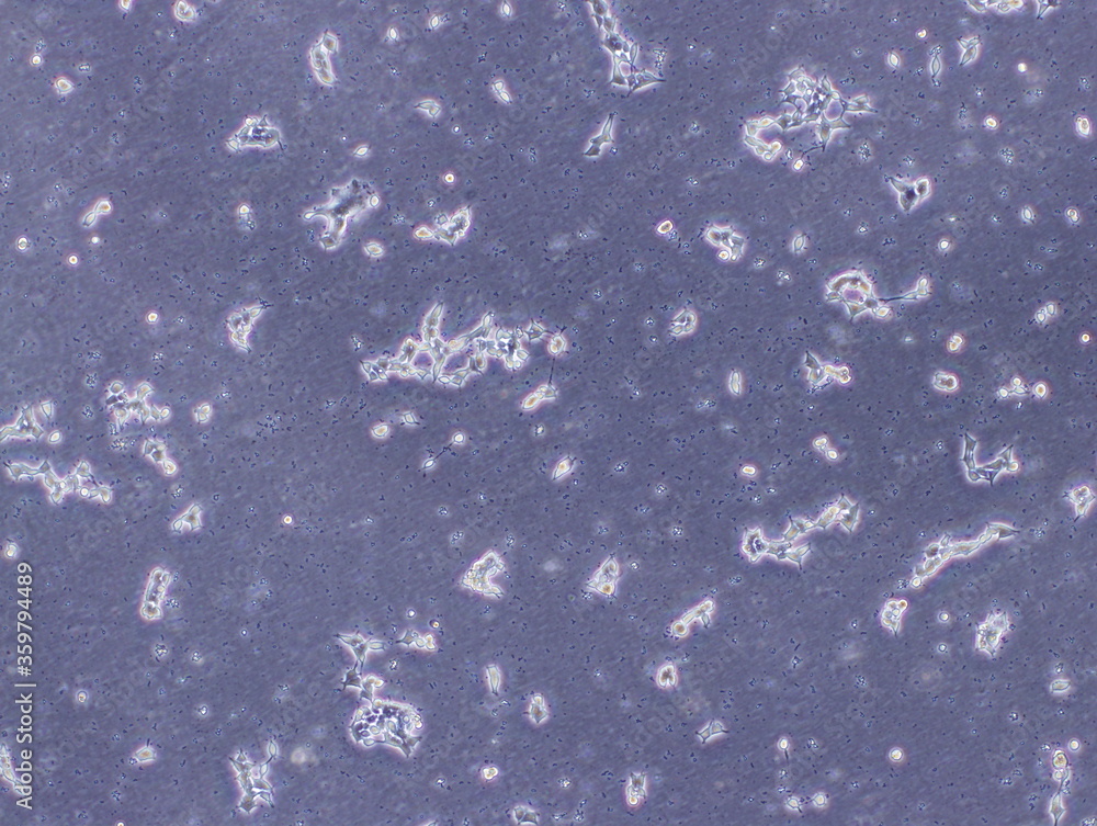 Human Brain Endothelial Cells (hCMEC/D3 cells) were captured by Light ...