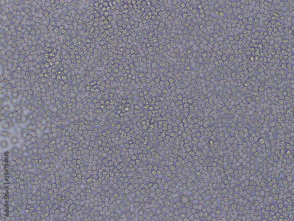 Mouse Macrophage Cells (TIB-67 Cells) were captured by Light Microscope ...